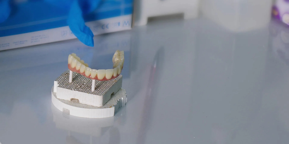 Unleashing the Power of Zirconia Blocks in Modern Dentistry - Topzir