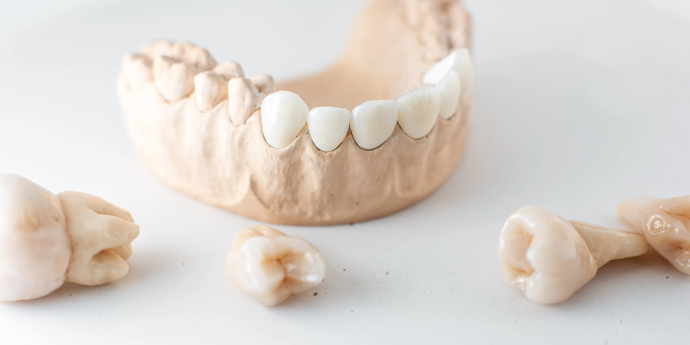 Zirconia Dental Crowns: Durable, Natural-Looking, and Here to Stay - Topzir