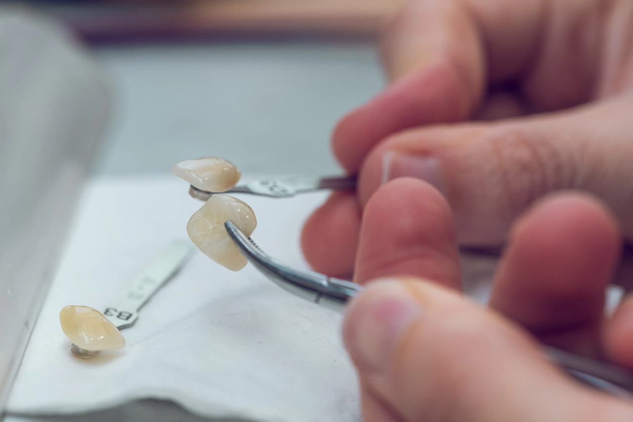 Matching Zirconia and Porcelain Crowns to Your Natural Tooth Color - Topzir