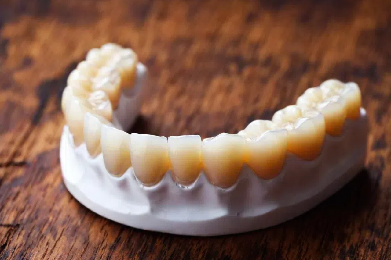 Breaking Down the Costs Is Permanent Zirconia Teeth Worth It - Topzir