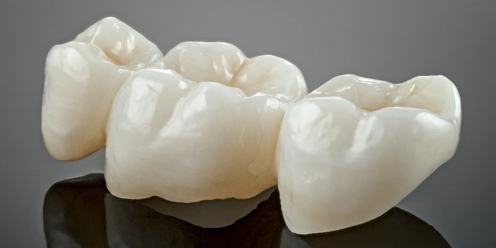 Zirconia Implants: A Superior Choice for Modern Dental Work - Topzir