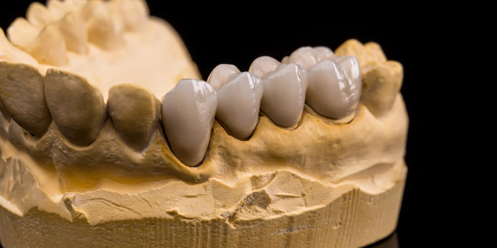 Cubic Zirconia Teeth vs. Traditional Materials Which is Right for You ...